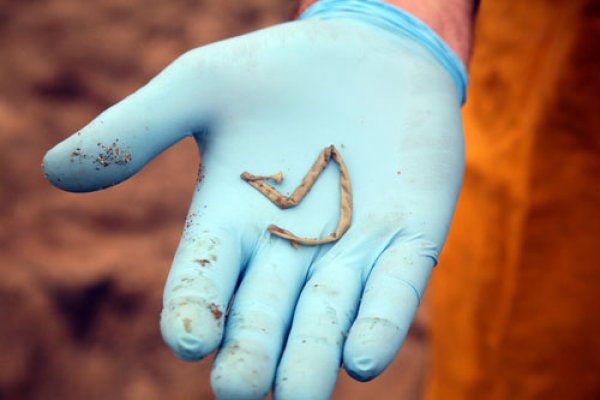 Parazity - každý ich má | Vitarian.sk